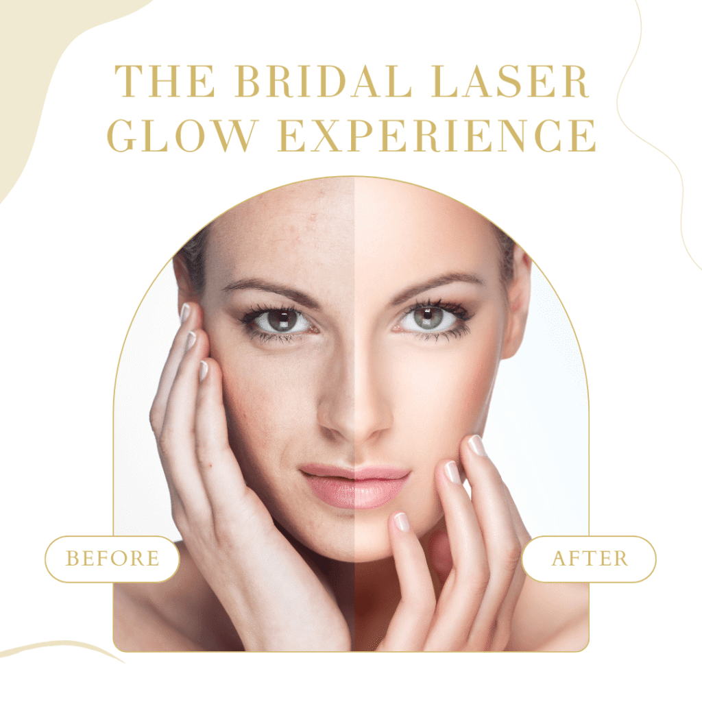 Bridal Beauty Prep: Why Charlotte Brides Choose Laser Facials at Twenty ...